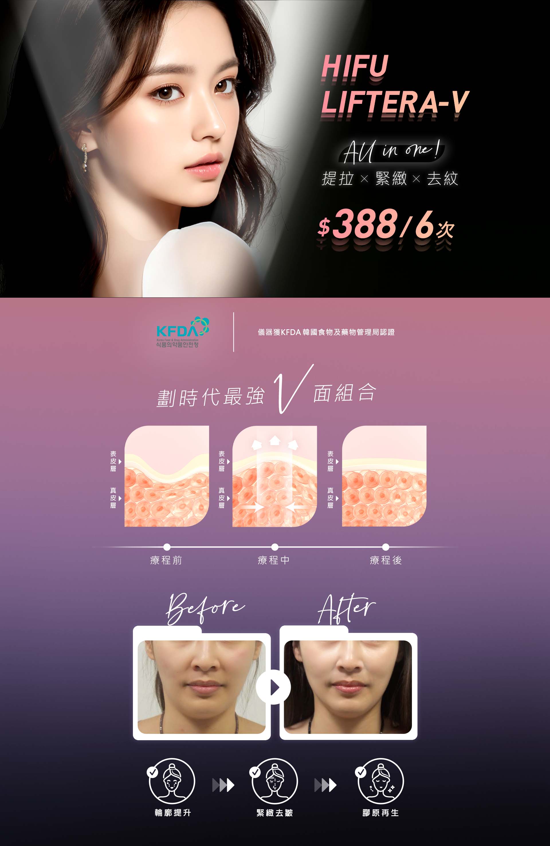 OnLux 肌底療程專家｜HIFU首選