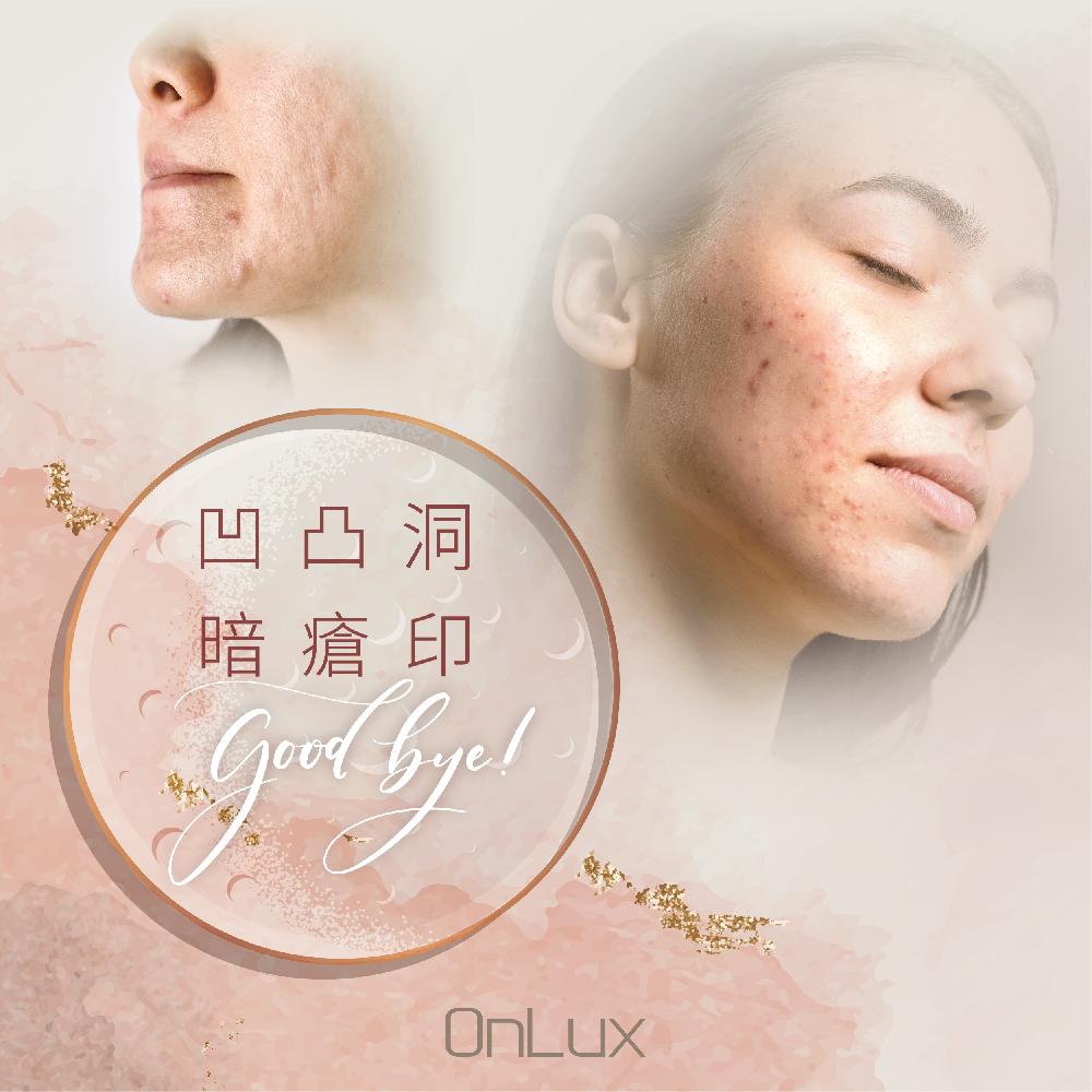 OnLux 小知識｜最新美容資訊｜OnLux 肌底療程專家